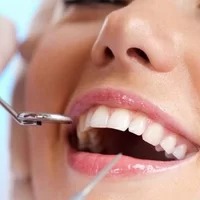 Dental Filling Services in Delhi | Tooth Filling